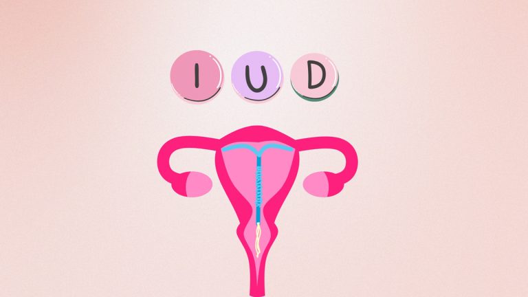 Understanding the Intrauterine Device (IUD): Types, Benefits, and ...